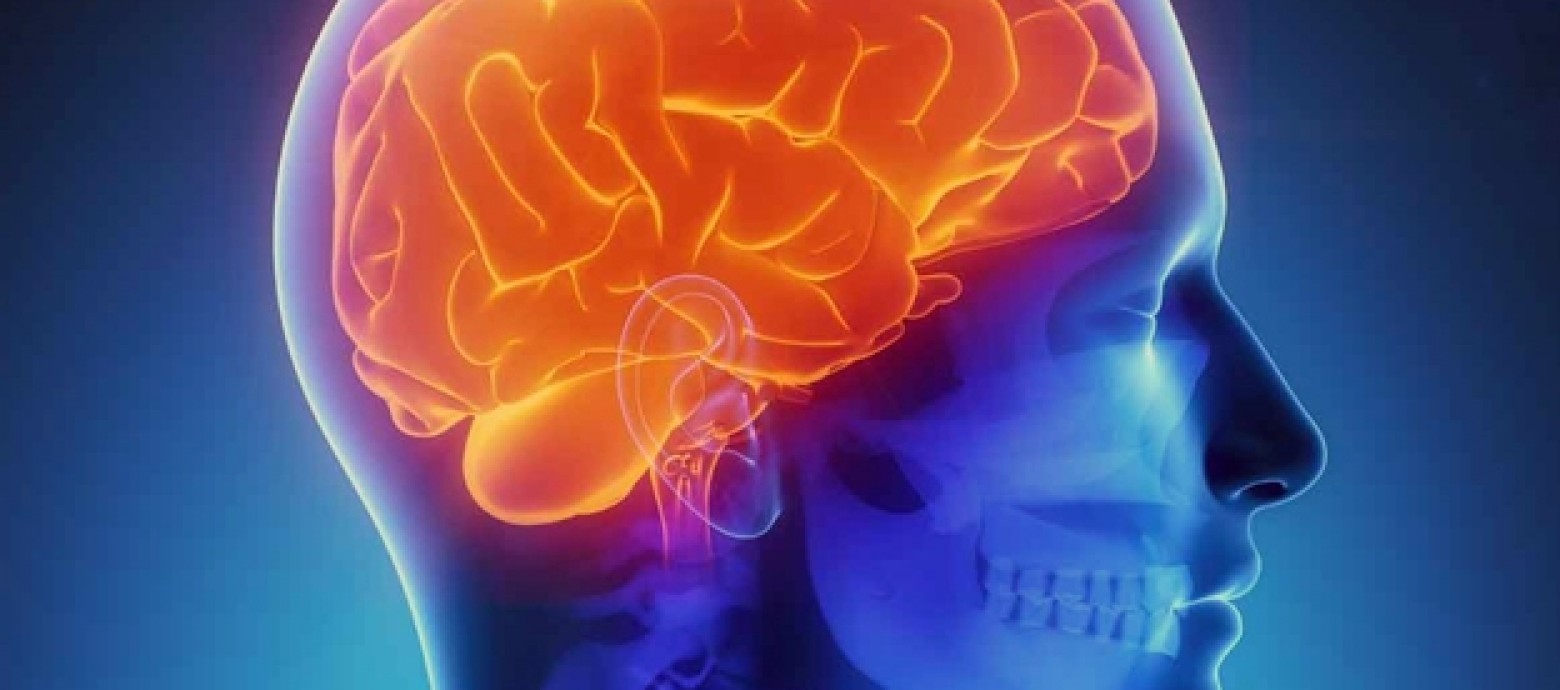 ¿Qué es un ACV o stroke? - TVSana