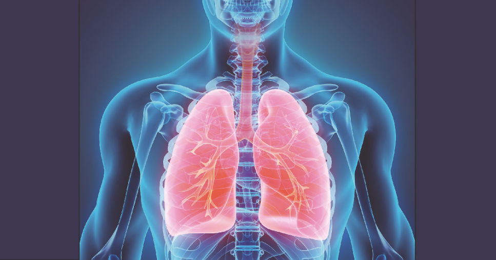 Neumonía, una infección pulmonar - TVSana